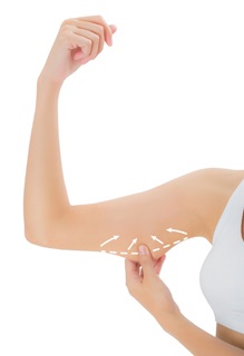 Body Contouring 101: Arm Edition in Bucks County, PA